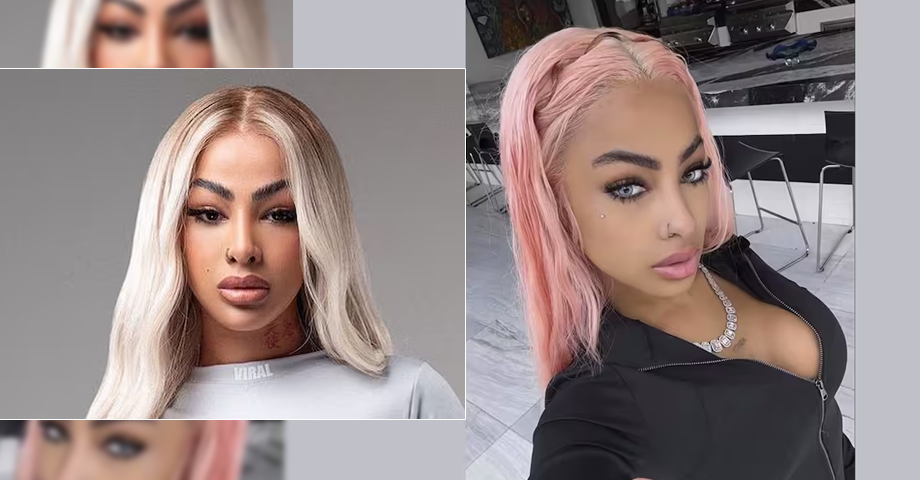 Yailin se somete a costoso tratamiento para cambiar de manera ...